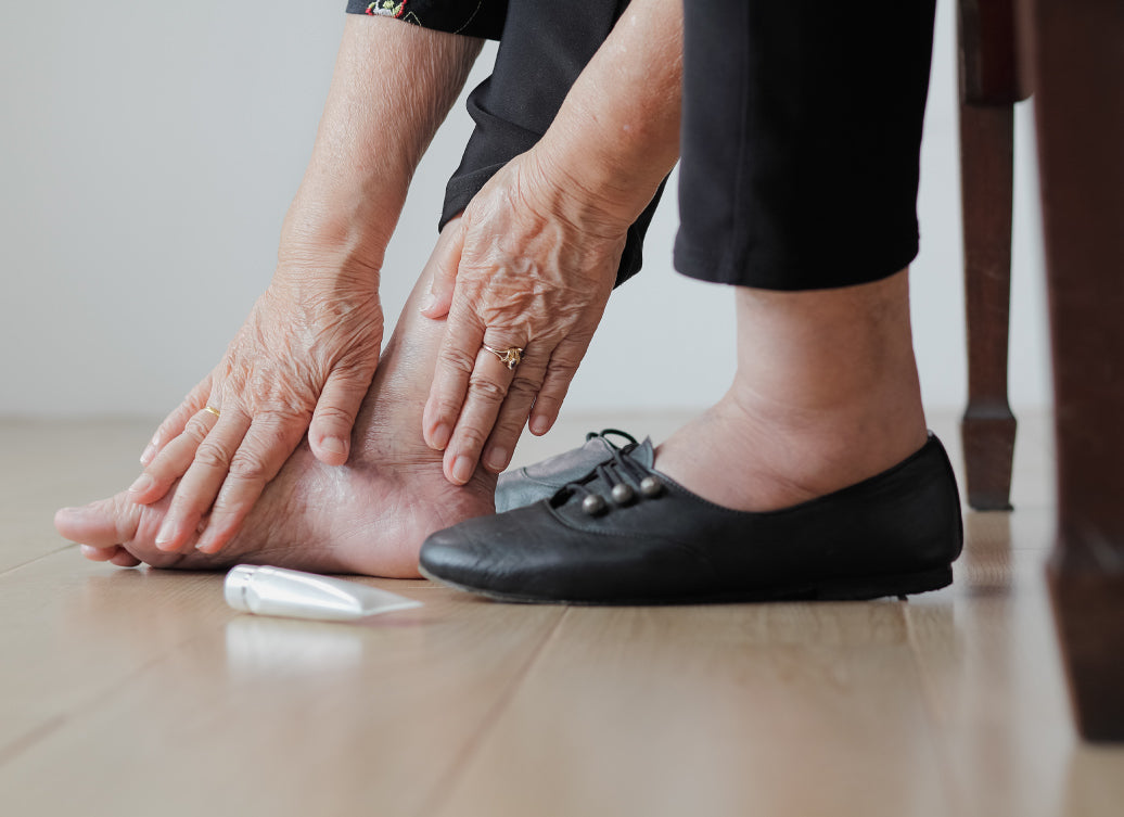 What Is The Best Treatment For Stasis Dermatitis Balmonds