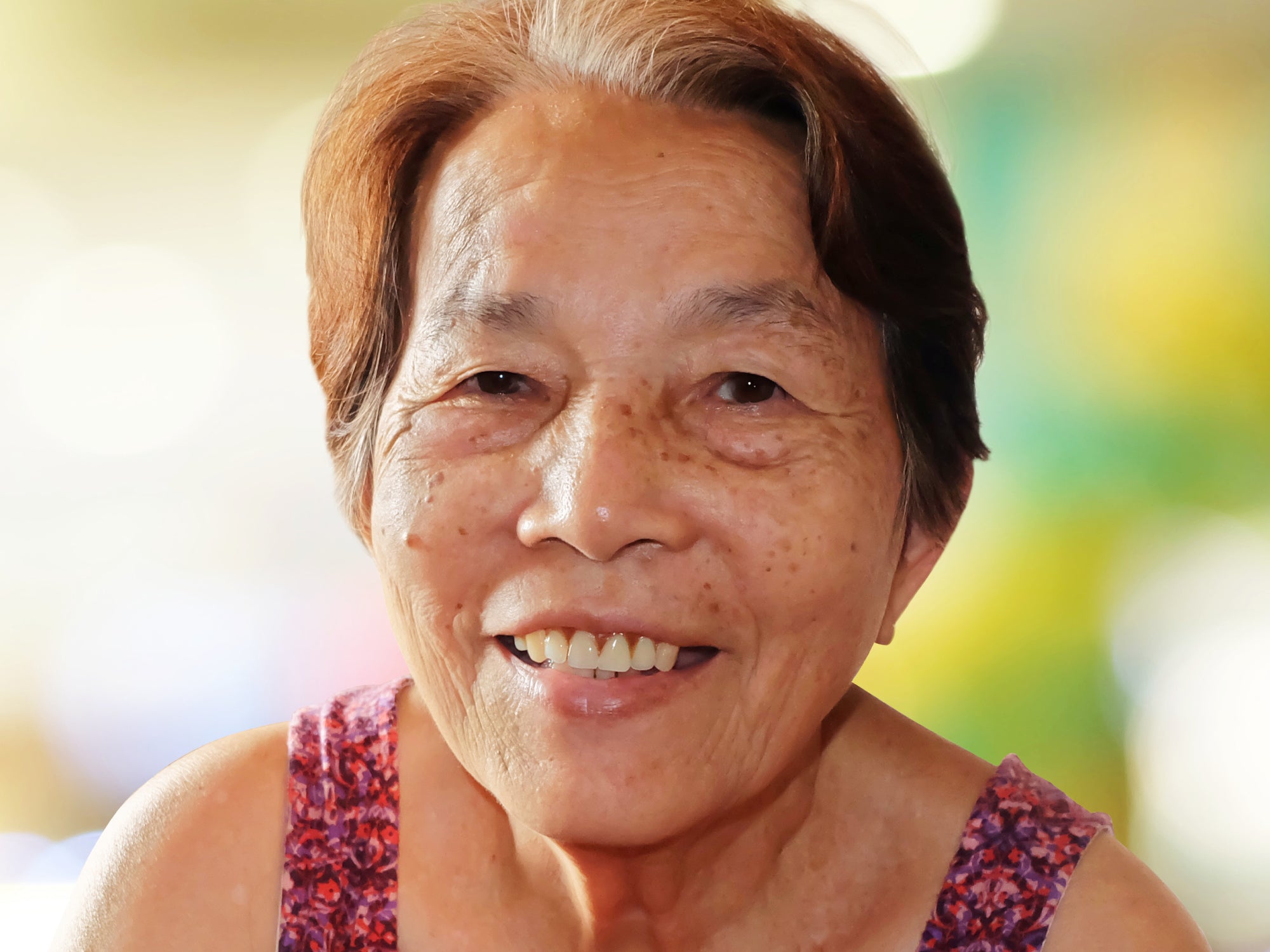 How Can I Improve My Hyperpigmentation? – Balmonds