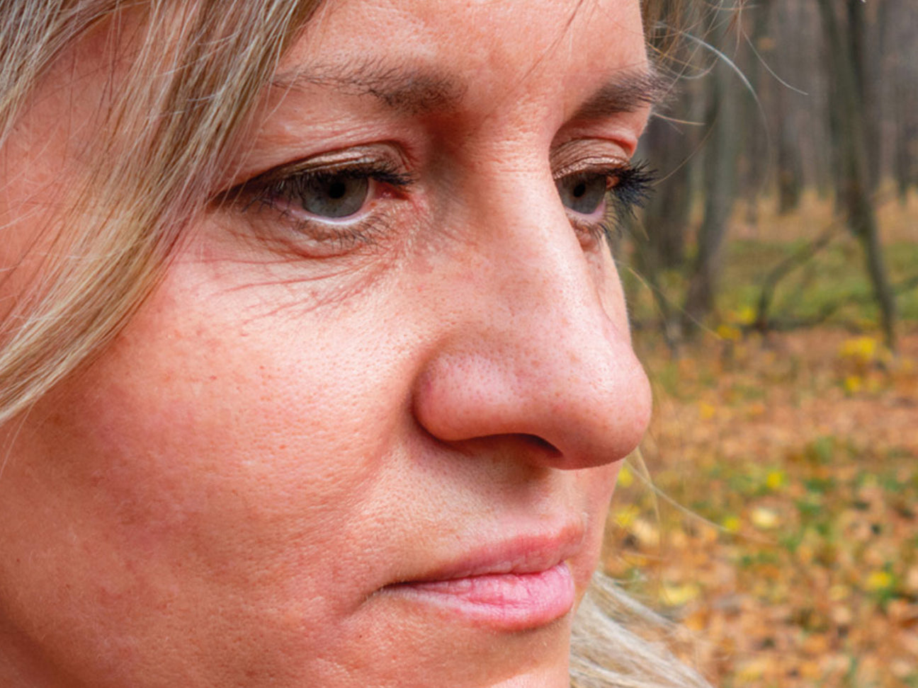 Red Skin Syndrome Or Topical Steroid Withdrawl (TSW): What's The Diffe ...