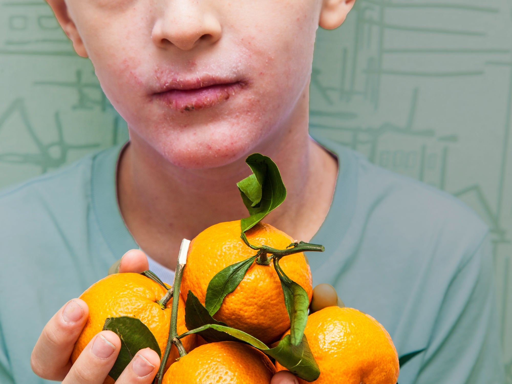 6 Signs You Might Have A Food Intolerance – Balmonds